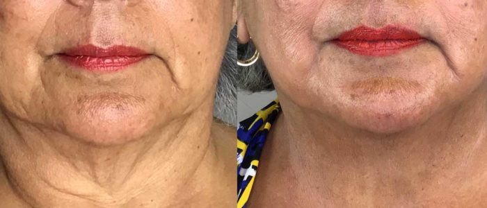 medAge Lift - medAge by Dr. Laura Ellis