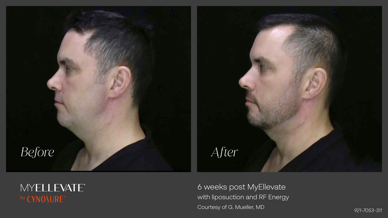 myEllevate - medAge Aesthetics & Wellness