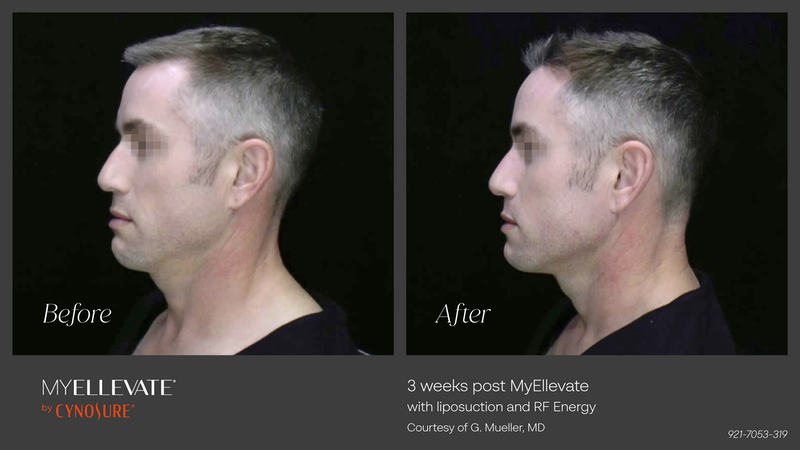 myEllevate - medAge Aesthetics & Wellness