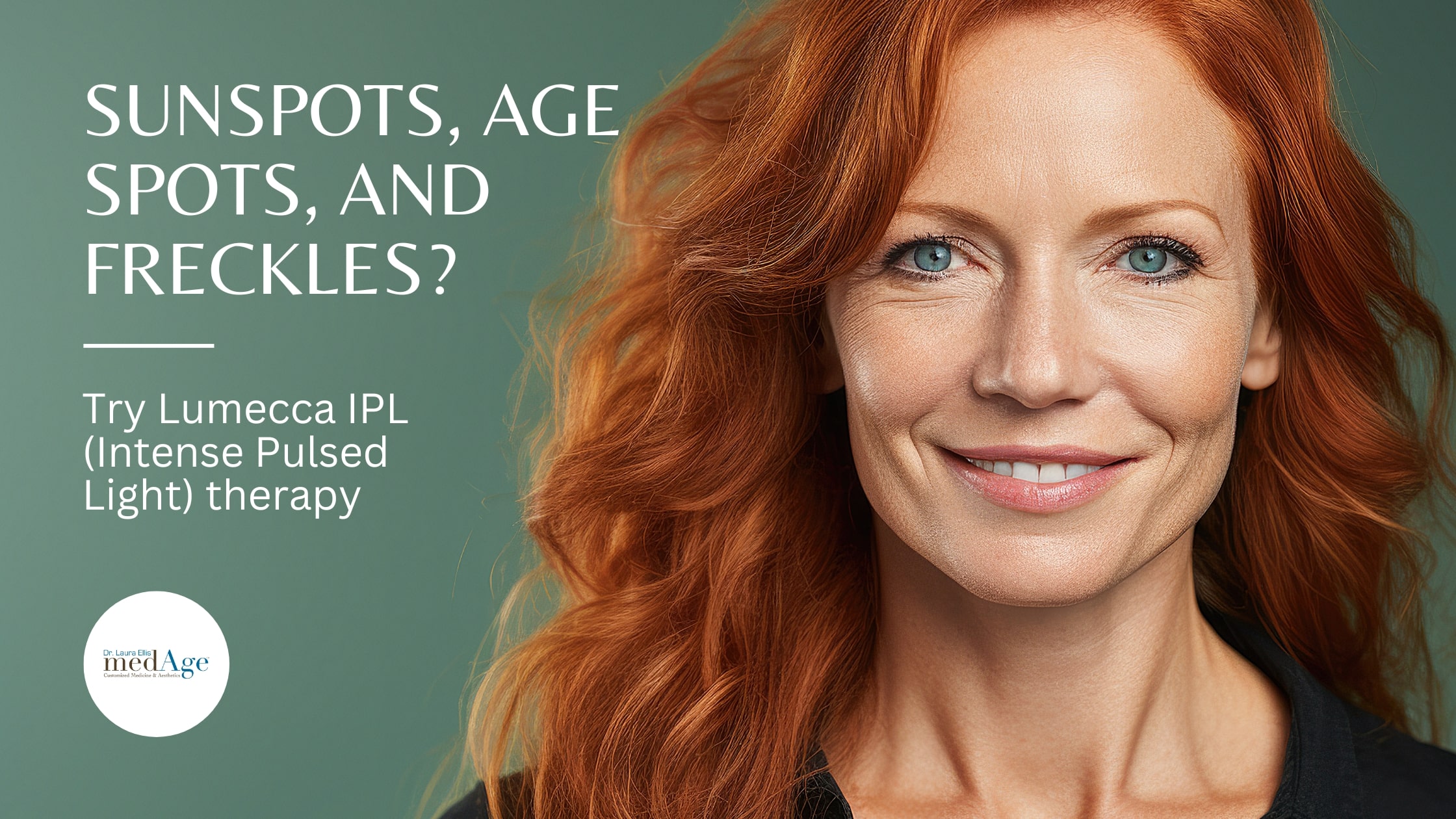 IPL Skin & Sun Spot Removal Treatments in Asheville & Greenville